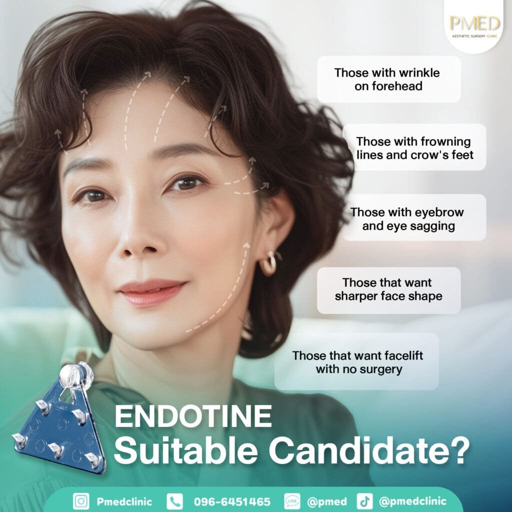 Endotine - PMED Clinic